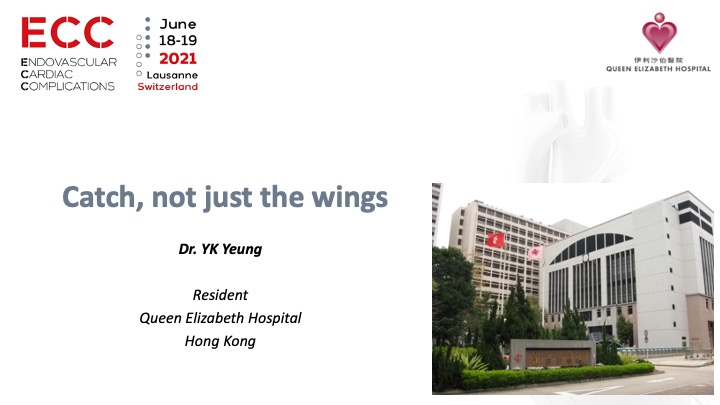 Catch, not just the wings - ECC Congress